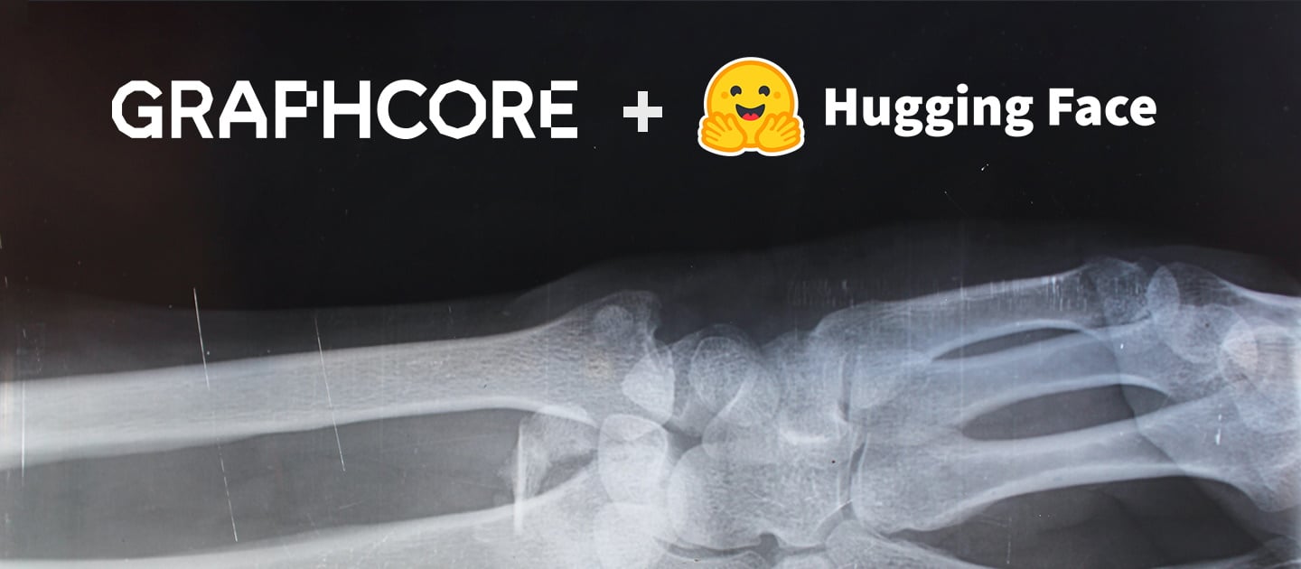 Deep dive: vision transformers on Hugging Face Optimum Graphcore